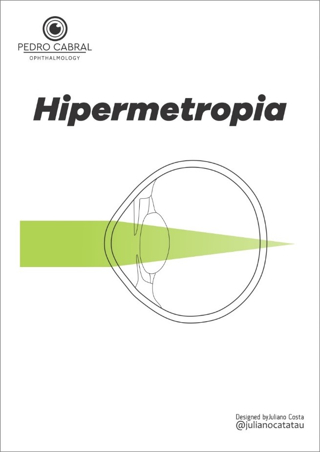 Hipermetropia - O que é e como tratar - Dr. Pedro Paulo Oftalmologista